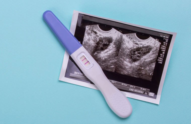 5 ways to boost your fertility | Reader's Digest New Zealand